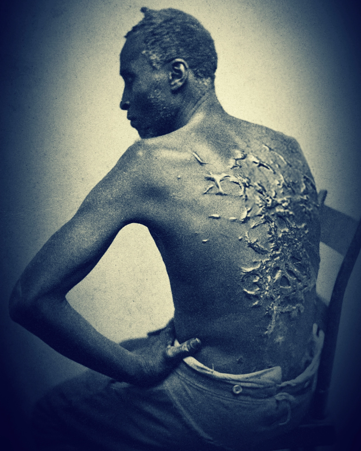 The story behind ‘The Scourged Back’ photograph | Abraham Lincoln ...